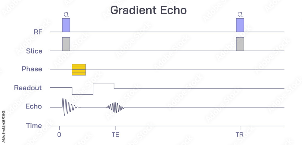 Gradient echo sequences, radiology reference article images, MRI ... Gradient echo sequences, radiology reference article images, MRI ...