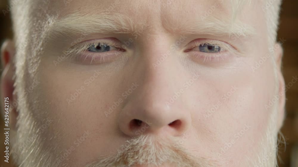 Male model with discolored hair pale skin. Concept of diversity ...