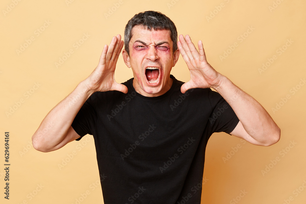 Emotional beaten man in black T-shirt with bruises and abrasions on his ...