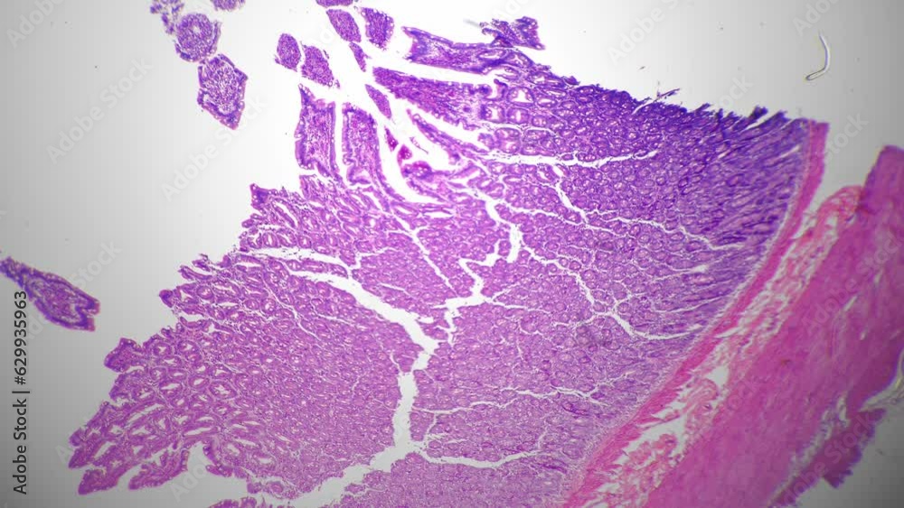 Vidéo Stock Large intestine of human being in section magnified under ...