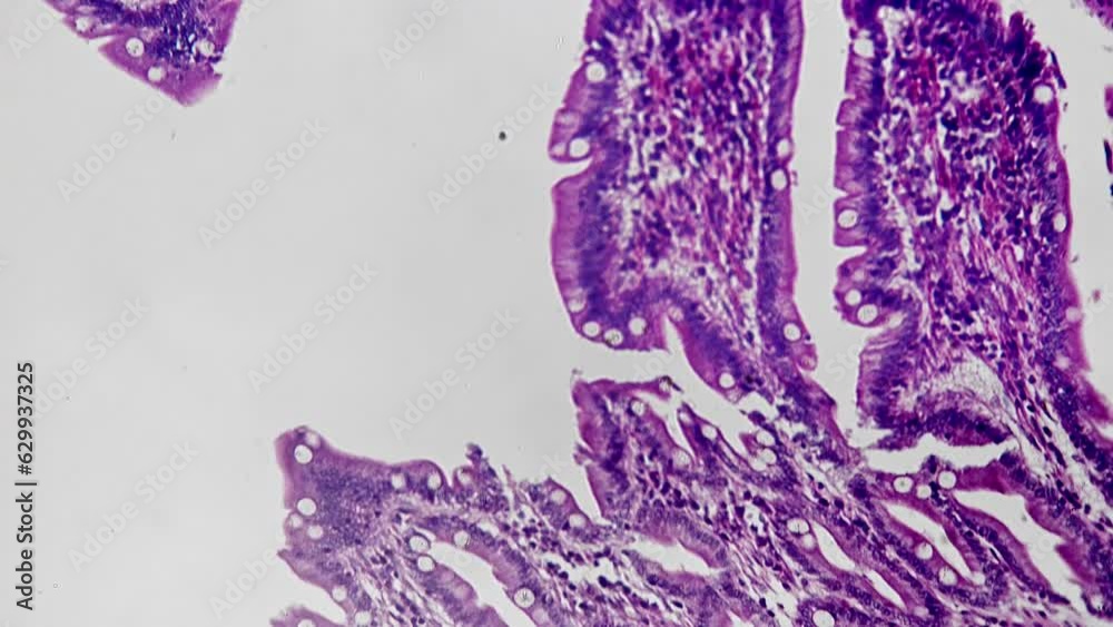 Human large intestine in section magnified under microscope in 200 ...