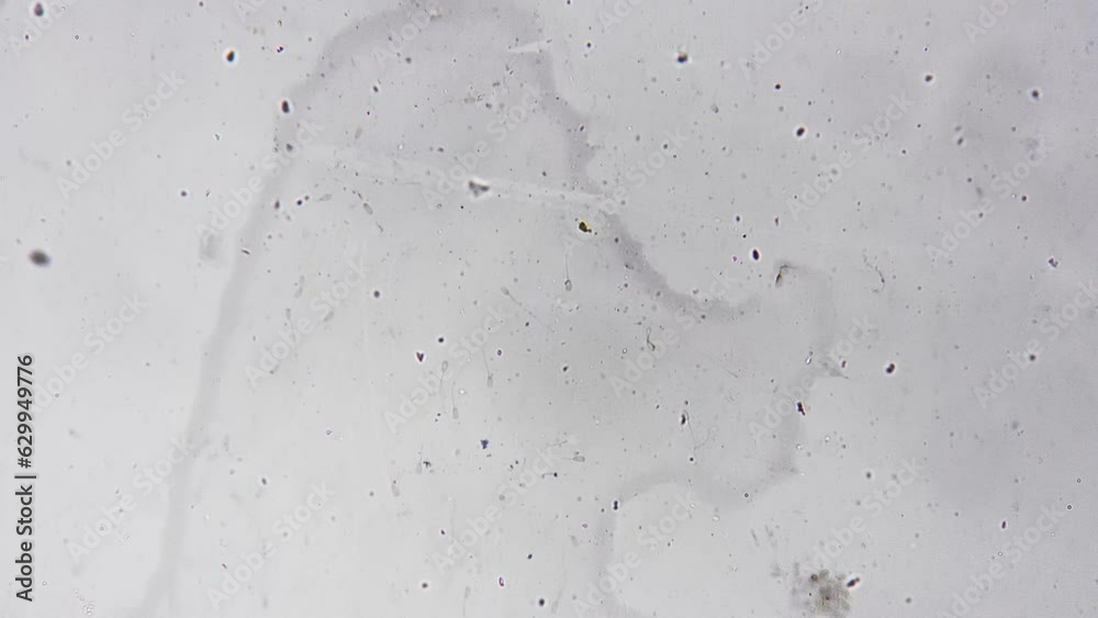 Macro footage of sperm smear sample magnified under microscope 200x and ...