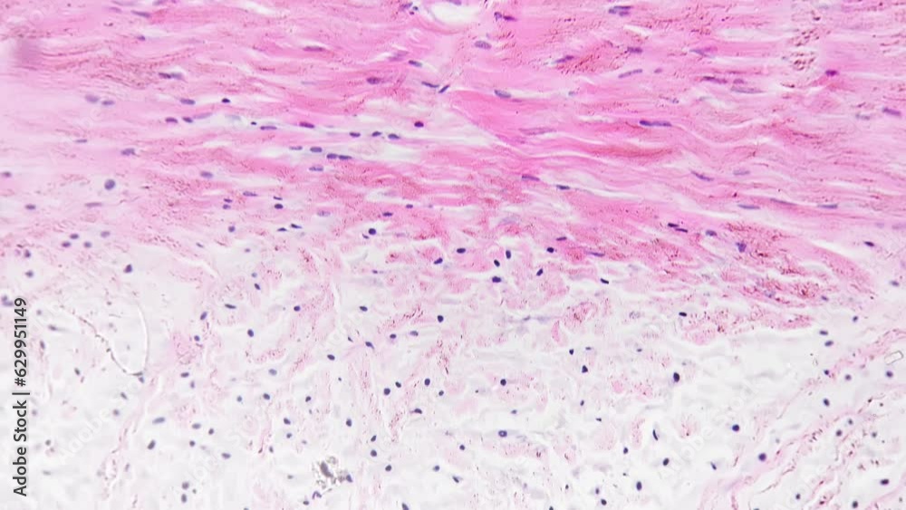Dense connective tissue of human whole mount filmed under microscope ...