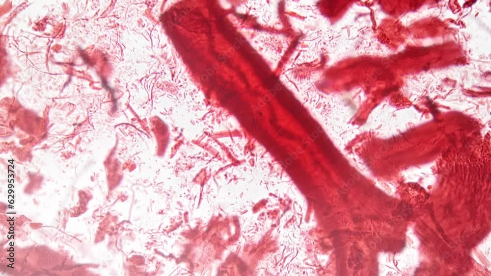 Highly magnified a whole mount of smooth muscle 200x against bright ...