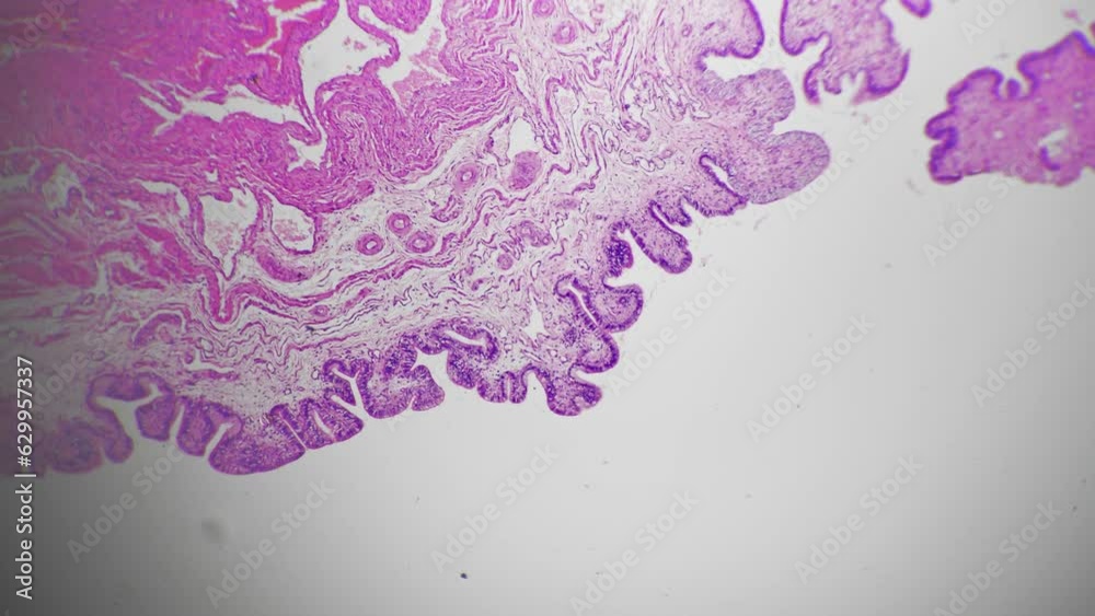 Section of human vagina magnified under microscope 40x on bright field ...