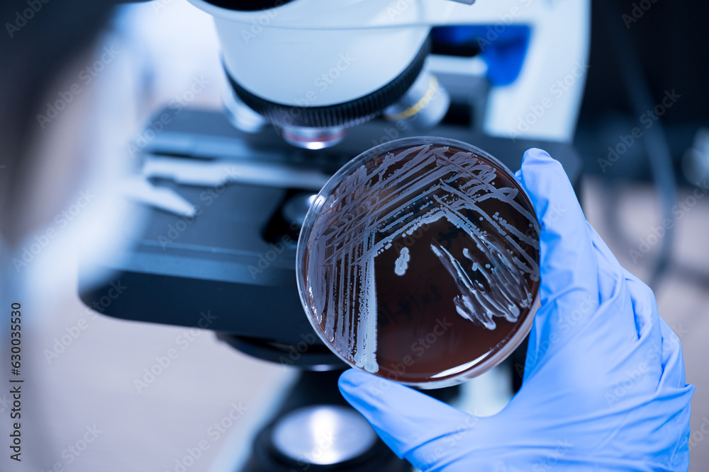 Scientist holding agar plate for diagnosis bacterial or microorganism ...