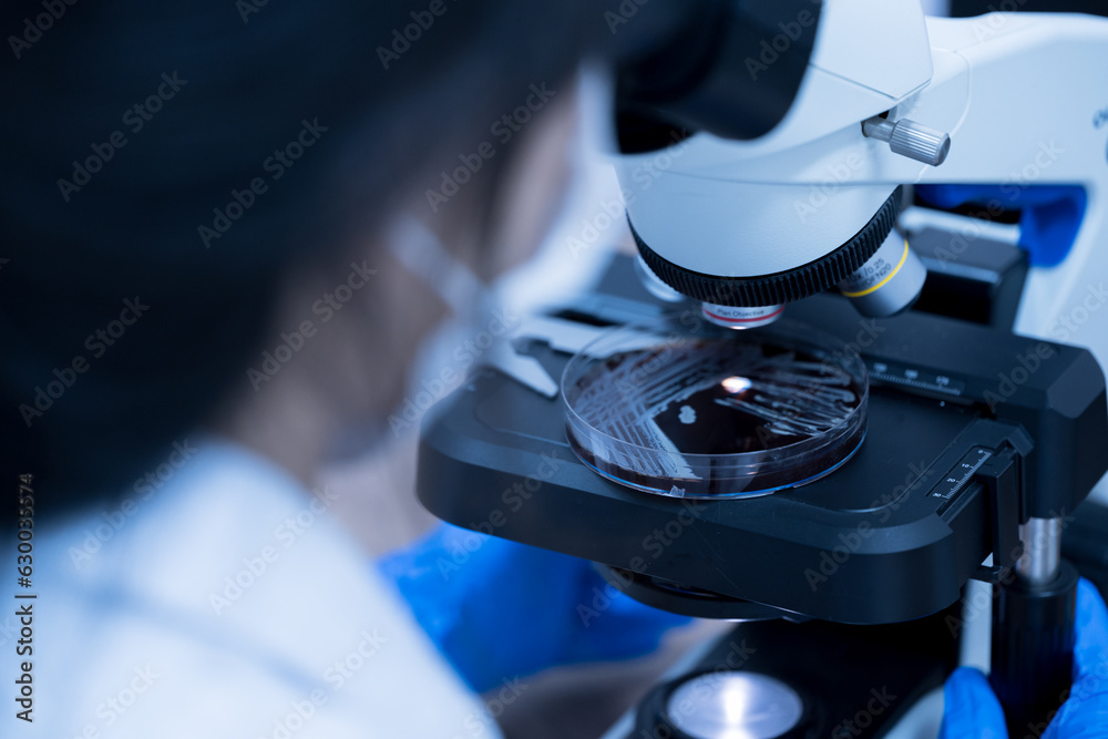 Scientist holding agar plate for diagnosis bacterial or microorganism ...