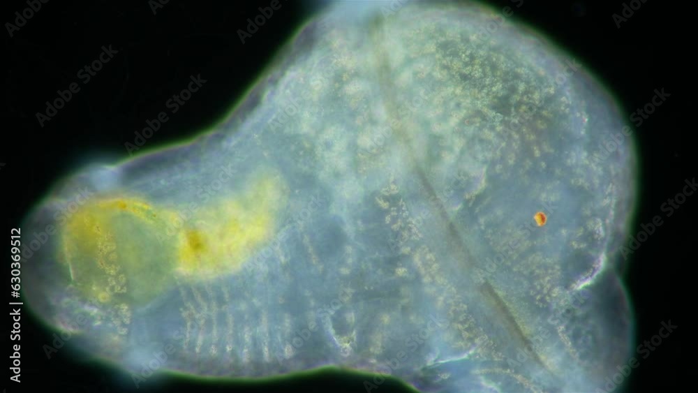 Larva of a worm at metatrochophore stage under a microscope, of family ...