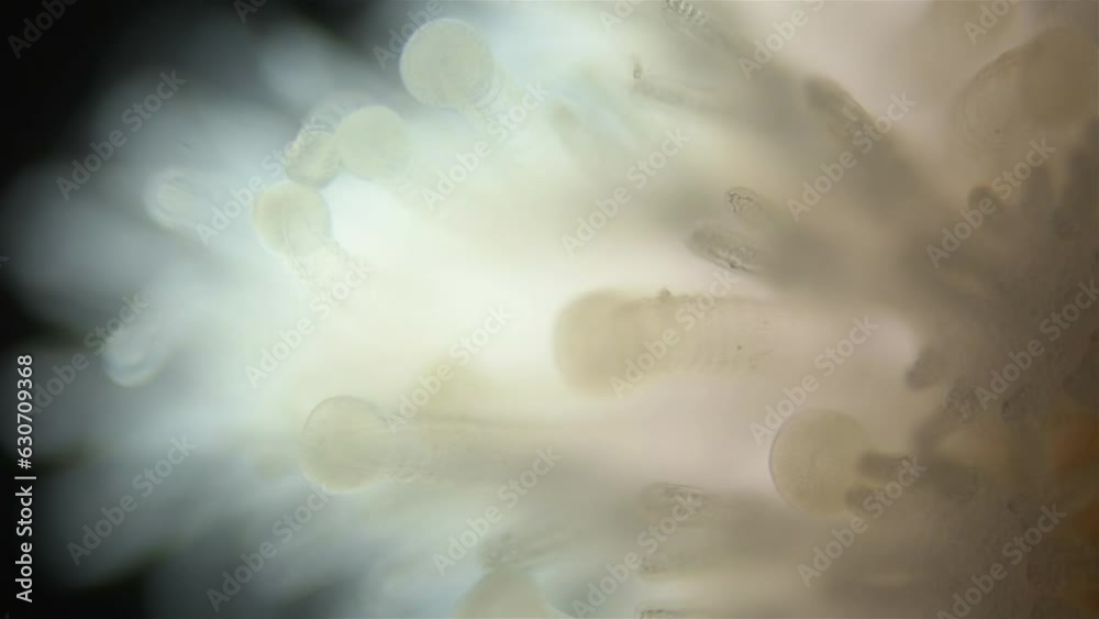 Young starfish Crossaster papposus under a microscope, Solasteridae ...