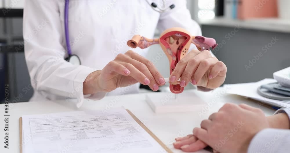 Gynecologist doctor breaks cigarette on background of layout of female ...