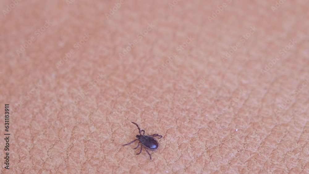parasite tick, mite from order Ixodidae, blood-sucking parasites crawls ...
