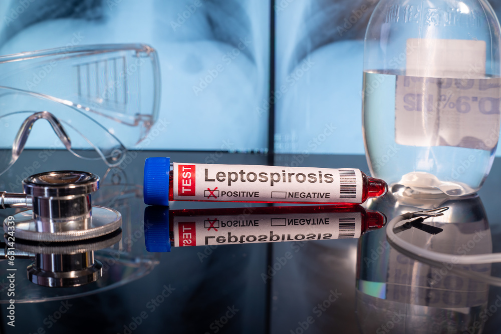 Blood collection tubes Leptospirosis test positive results ...