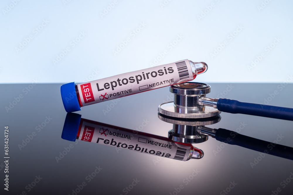 Blood collection tubes Leptospirosis test positive results ...