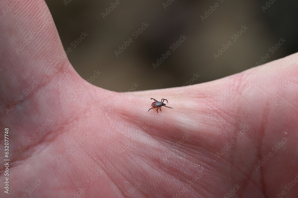 A tick walking on the hand. It is a dangerous arachnid that is a vector ...