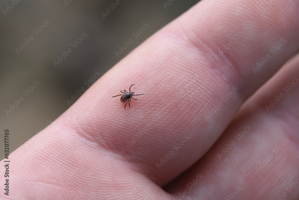 A tick walking on the hand. It is a dangerous arachnid that is a vector ...