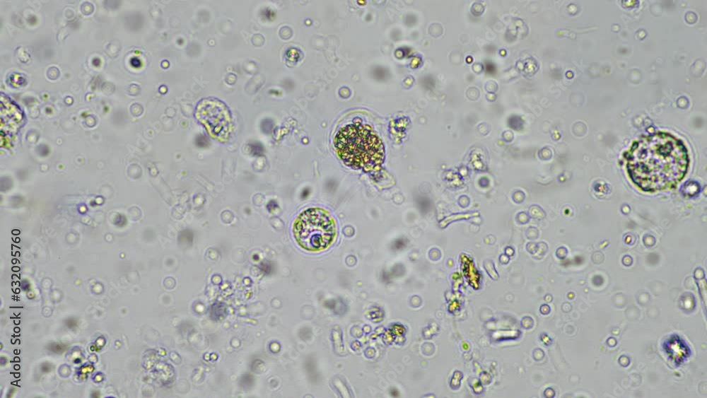 living soil life in a soil sample under the microscope in a lab Stock ...