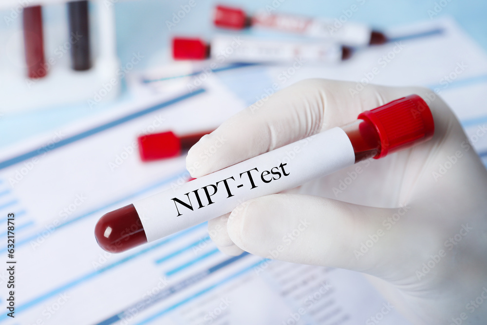 Noninvasive prenatal testing (NIPT). Nurse holding test tube with blood ...