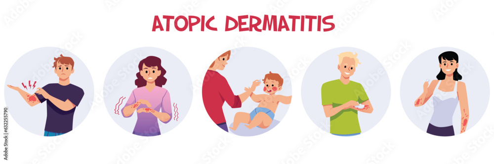 Set of people with atopic dermatitis flat style, vector illustration ...