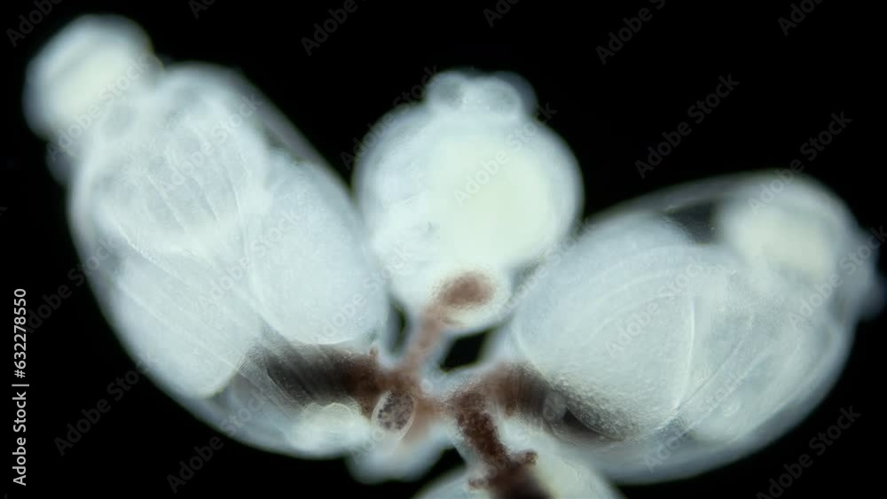 Gonophores chidaria Tubularia sp. under microscope, class Hydrozoa. An ...