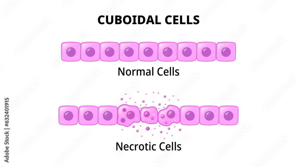 Cuboidal Cells - Normal Cell - Necrotic Cell - Medical Vector ...