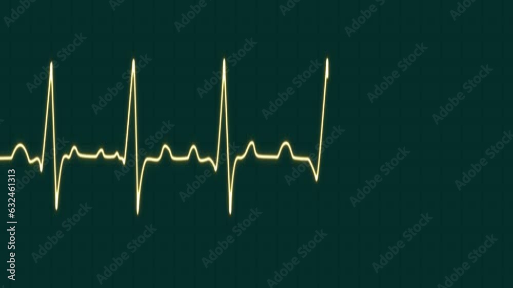 Cardiograph heartbeat pulse rate line glowing yellow neon light loop ...