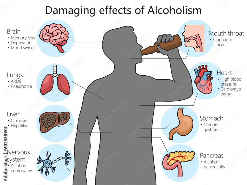 harmful effects of alcohol on the human body diagram schematic vector ...