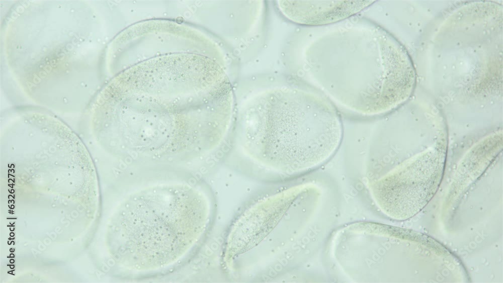 Sperm and ovule of worm Polychaeta Ophelia limacina under microscope ...