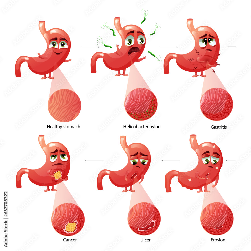 Stomach diseases. Cartoon character with emotions. Diagram diseases ...