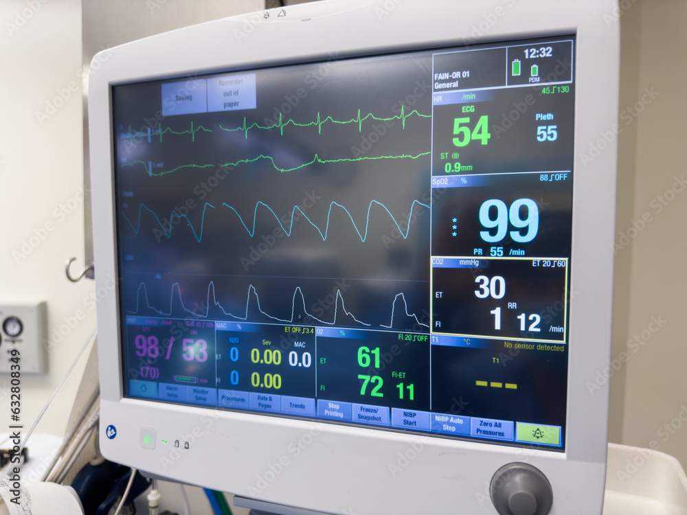Hospital monitors display vital signs: hemodynamics, heart rate, blood ...