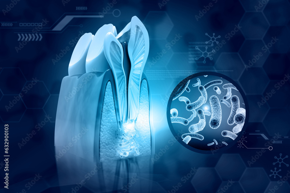 Human tooth cross section. Cavities,tooth decay. 3d illustration. Stock ...