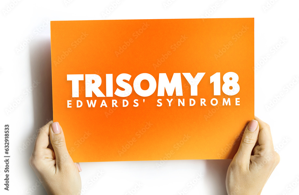 Trisomy 18 (Edwards syndrome) - is a chromosomal condition associated ...