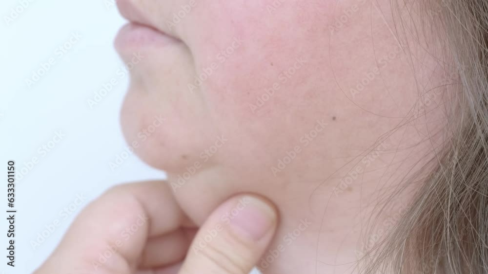 close up Double chin face mature woman 45 years old, human fat neck ...