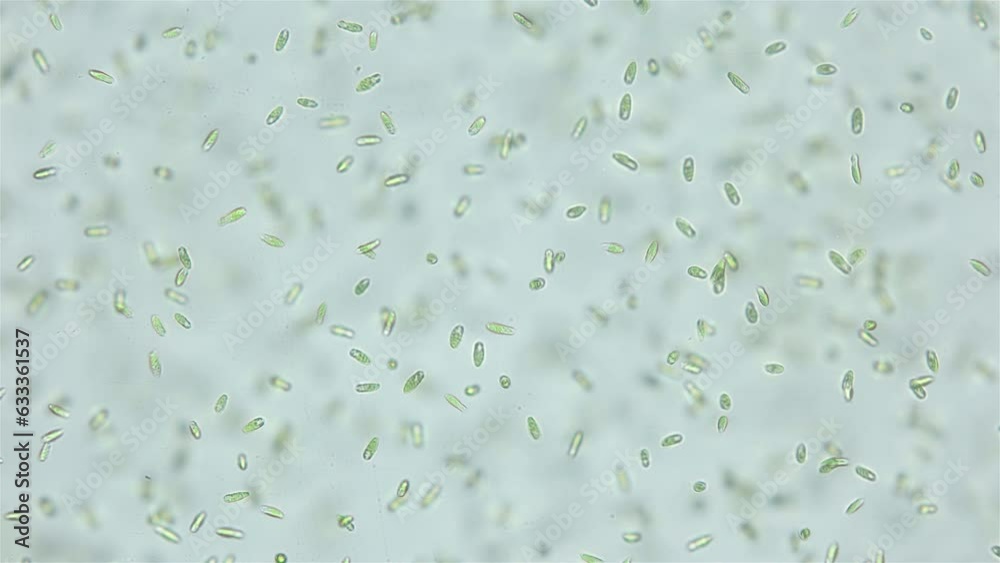 Unicellular algae Dunaliella salina under the microscope, Chlorophyta ...