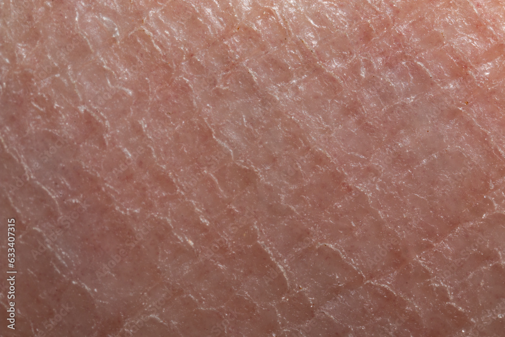 Foto de Skin diseases concept. macrophotograph of human skin under ...