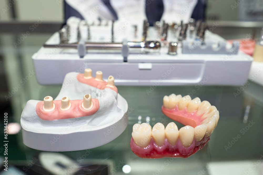 Dental prostheses. Models of human jaws. Visual aid for teaching ...