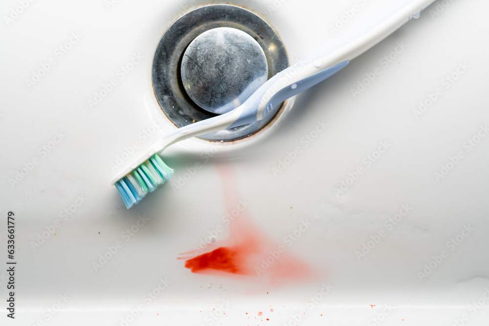 Toothbrush in a white washbasin with blood. Problem with gums Stock ...