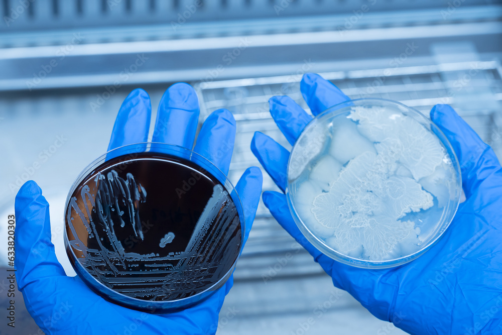 Scientist hand wearing blue gloves hold agar plate for diagnosis ...