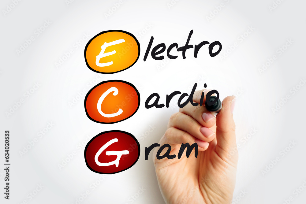 ECG Electrocardiogram - simplest and fastest tests used to evaluate the ...