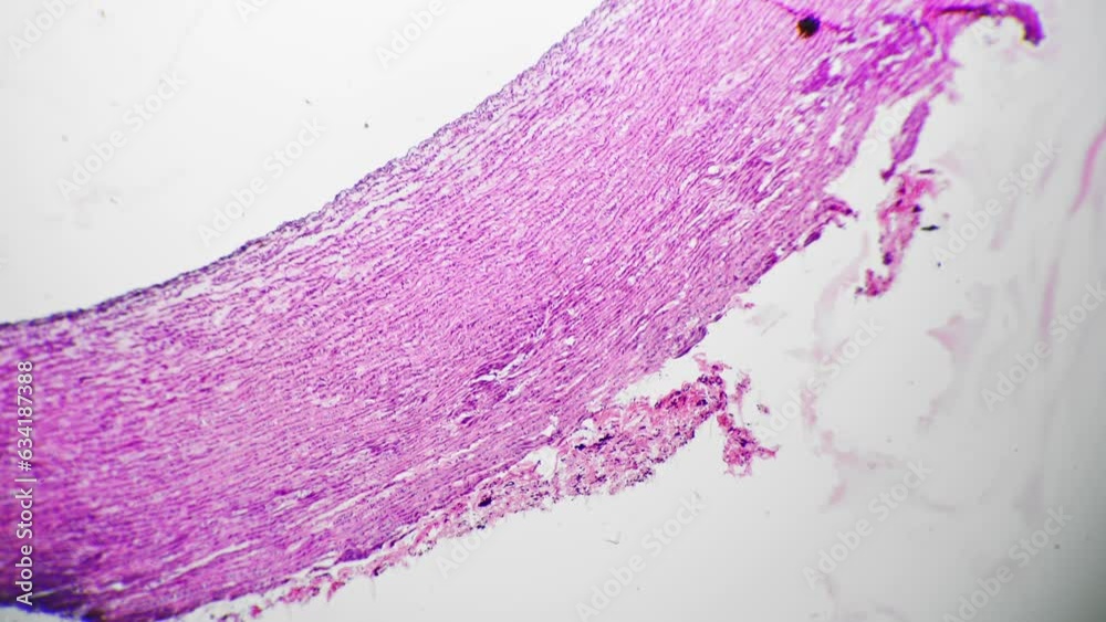 Artery of human being in longitudinal section filmed under microscope ...