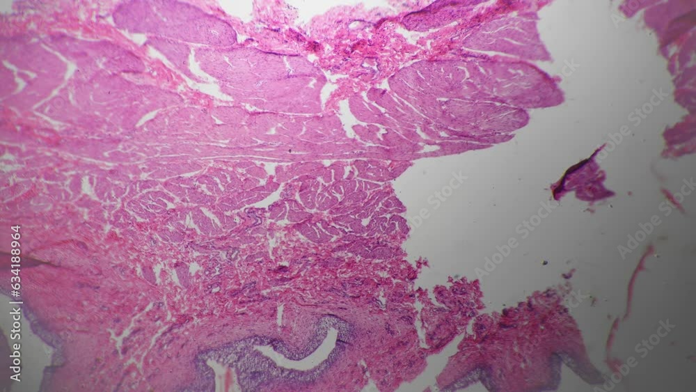 Bladder of human being in section filmed under microscope 40x for ...