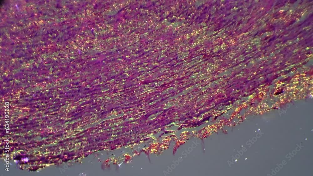 Section of artery magnified under microscope 100x and filmed with ...