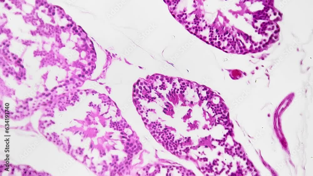 Testis in section of human being at scientific slide magnified under ...