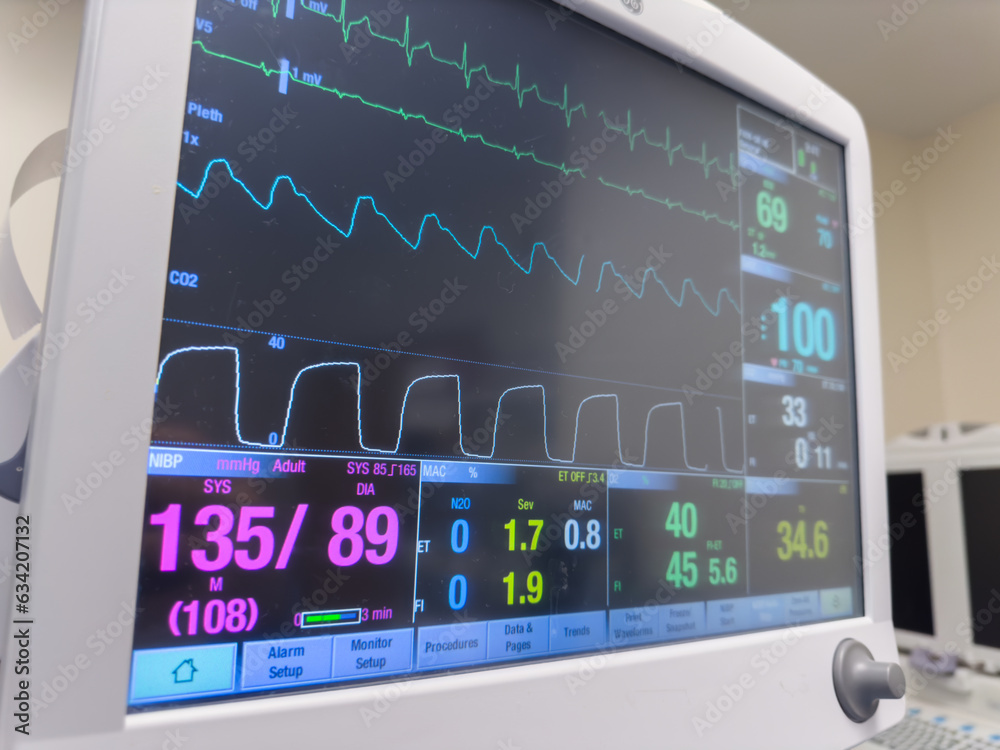 Hospital monitors display vital signs: heart rate, oxygen saturation ...