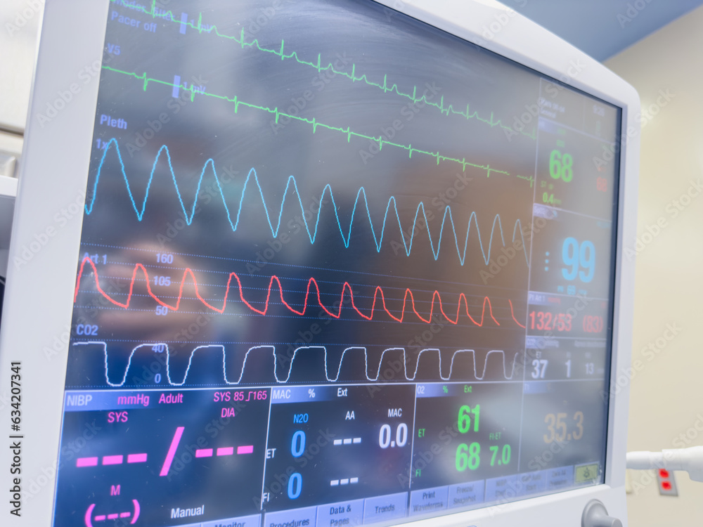 Hospital monitors display vital signs: heart rate, oxygen saturation ...