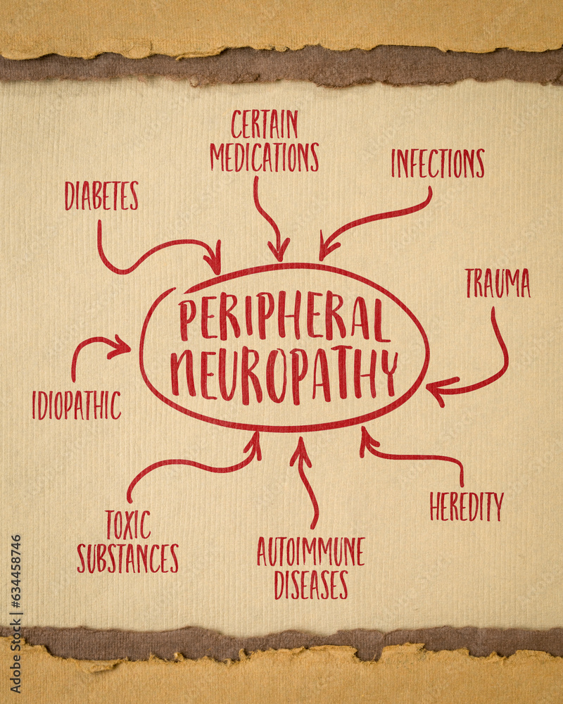 Causes Of Peripheral Neuropathy Infographics Or Mind Map Sketch On Art