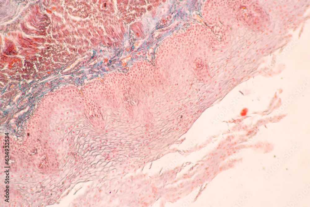 Showing Light micrograph of the Sublingual gland, Oesophagus human and ...