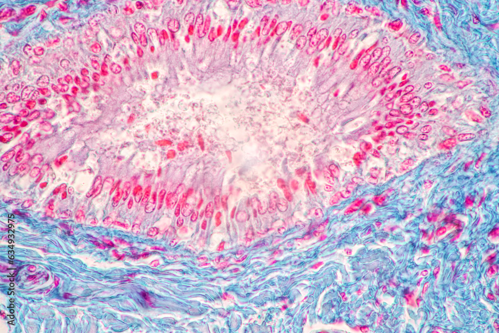 Fotografia do Stock: Showing Light micrograph of the Sublingual gland ...