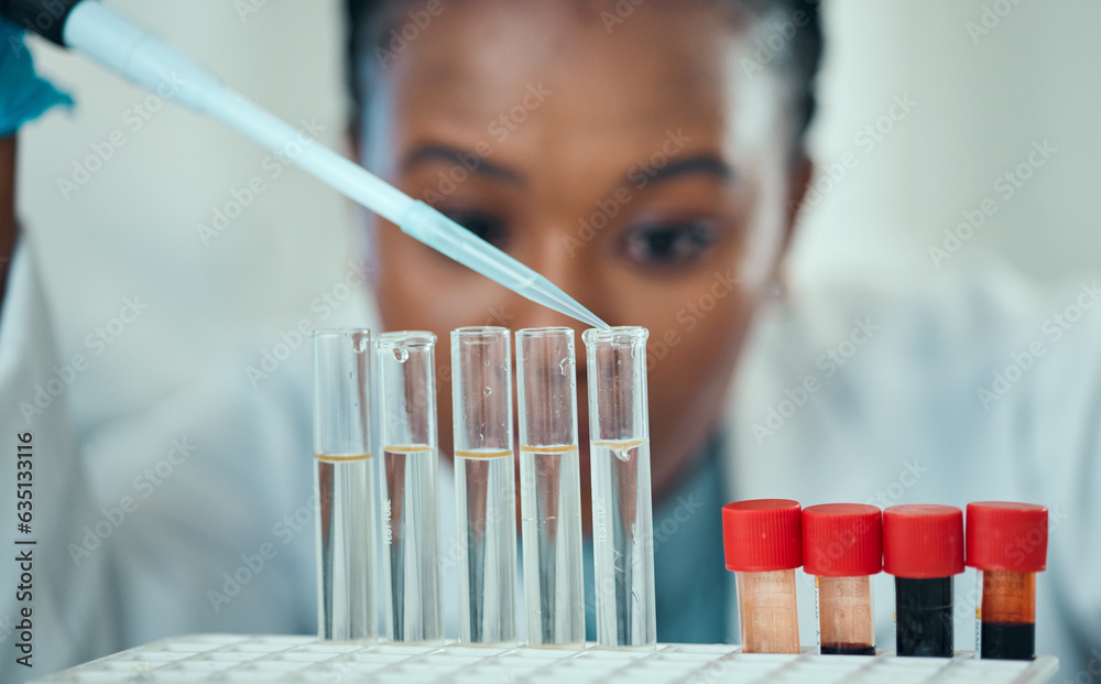 Science, woman with pipette and blood in test tube, laboratory research ... Science, woman with pipette and blood in test tube, laboratory research ...