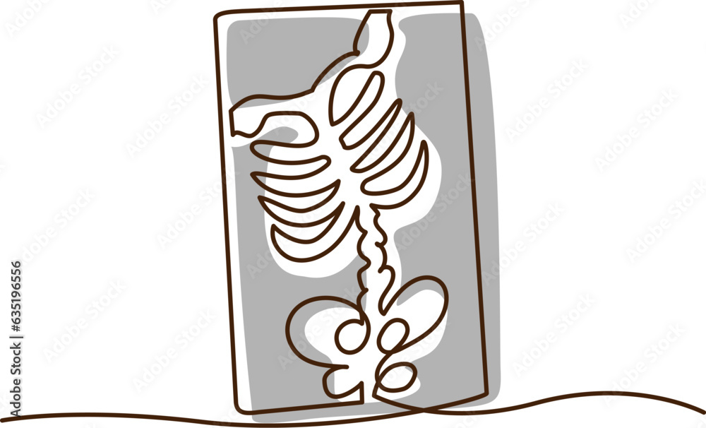Chest x-ray icon. A simple line drawing of the bones of the thorax on ...