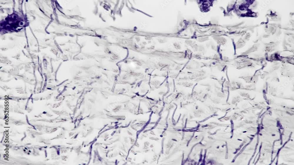 Footage of the skin section surrounding hair follicle using a ...